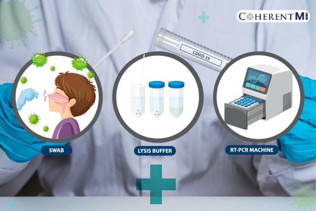 Rapid Influenza Diagnostic Tests: A Quick Way to Detect Influenza