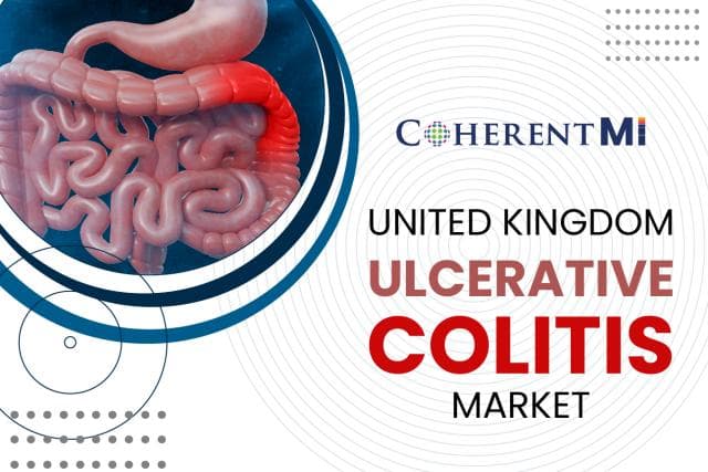 Prevalence of Ulcerative Colitis Continues to Rise in the UK